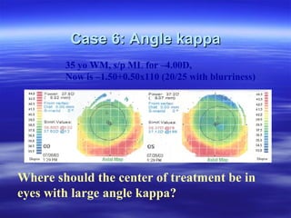 Refractive optics | PPT
