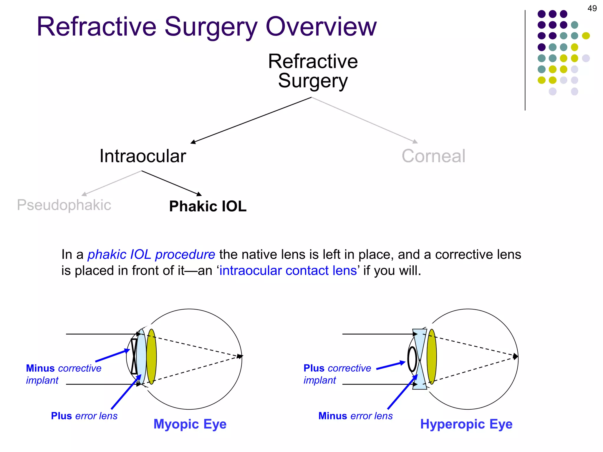 Refractive surgery.pptx
