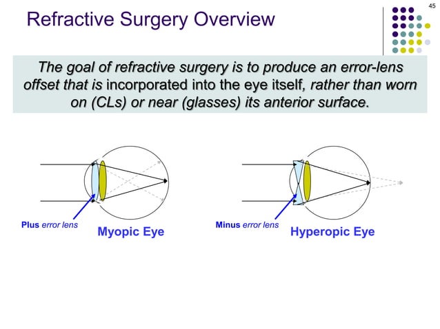 Refractive surgery.pptx