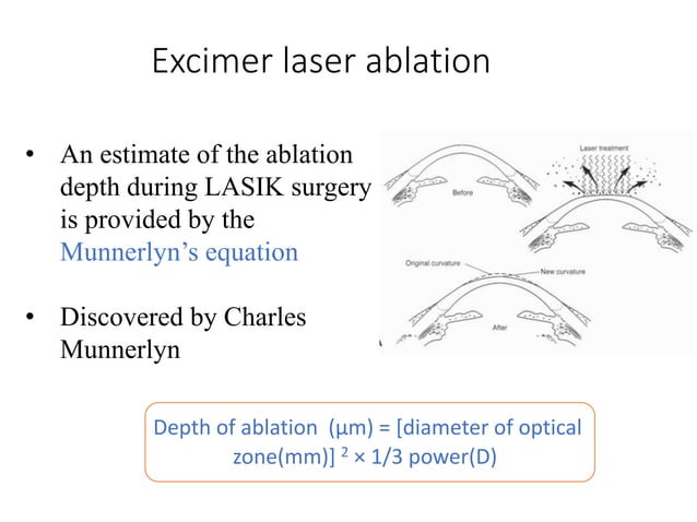Refractive Surgery- Principle, Selection of eyes, Instruments ...