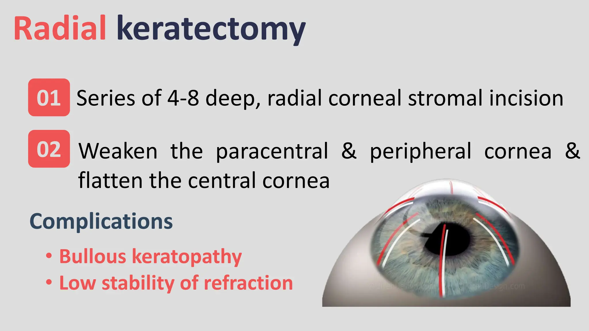 REFRACTIVE SURGERY.pptx