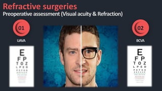 REFRACTIVE SURGERY.pptx
