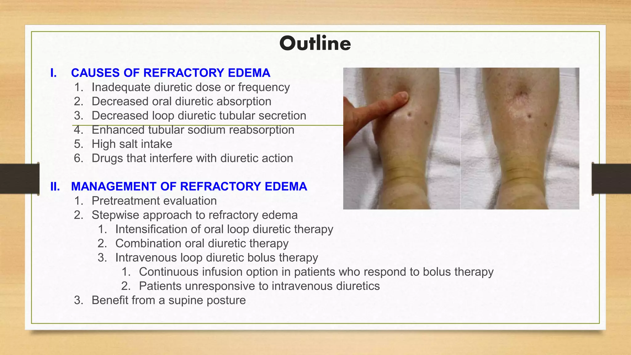 Refractory Edema | PPTX