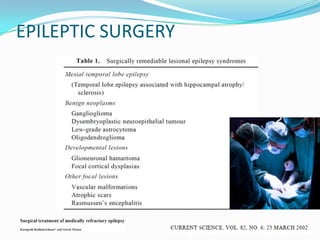 Refractory epilepsy | PPT