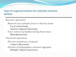 Refractory epilepsy | PPT