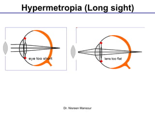 Refractory Media Of Eye S4 March 10 | PPT