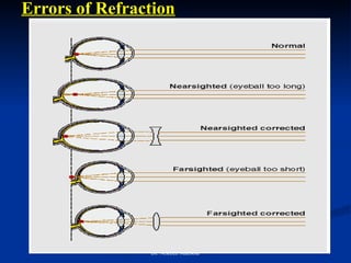 Refractory Media Of Eye S4 March 10 | PPT