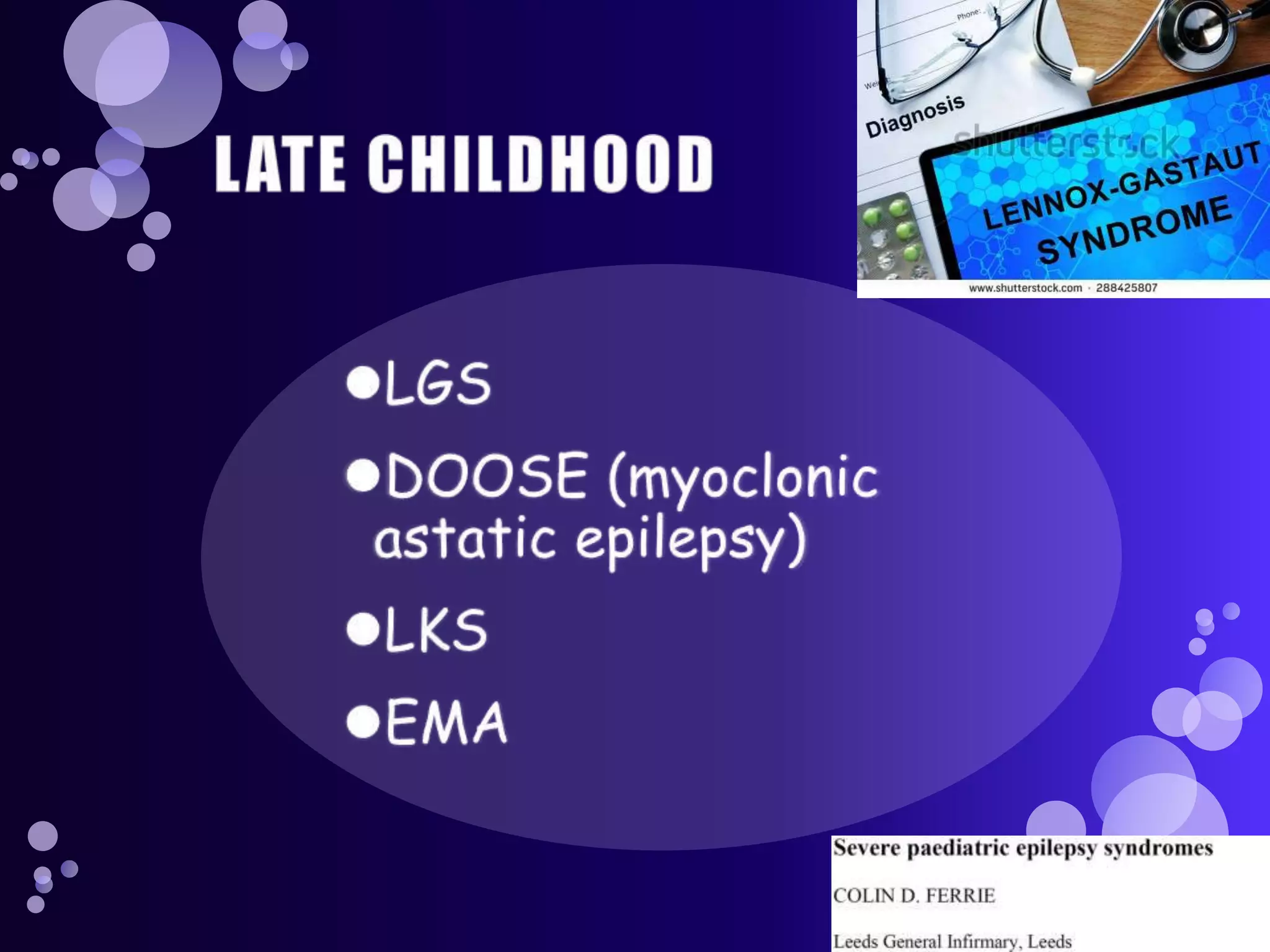 Refractory pediatric epilepsy ,Management | PPTX