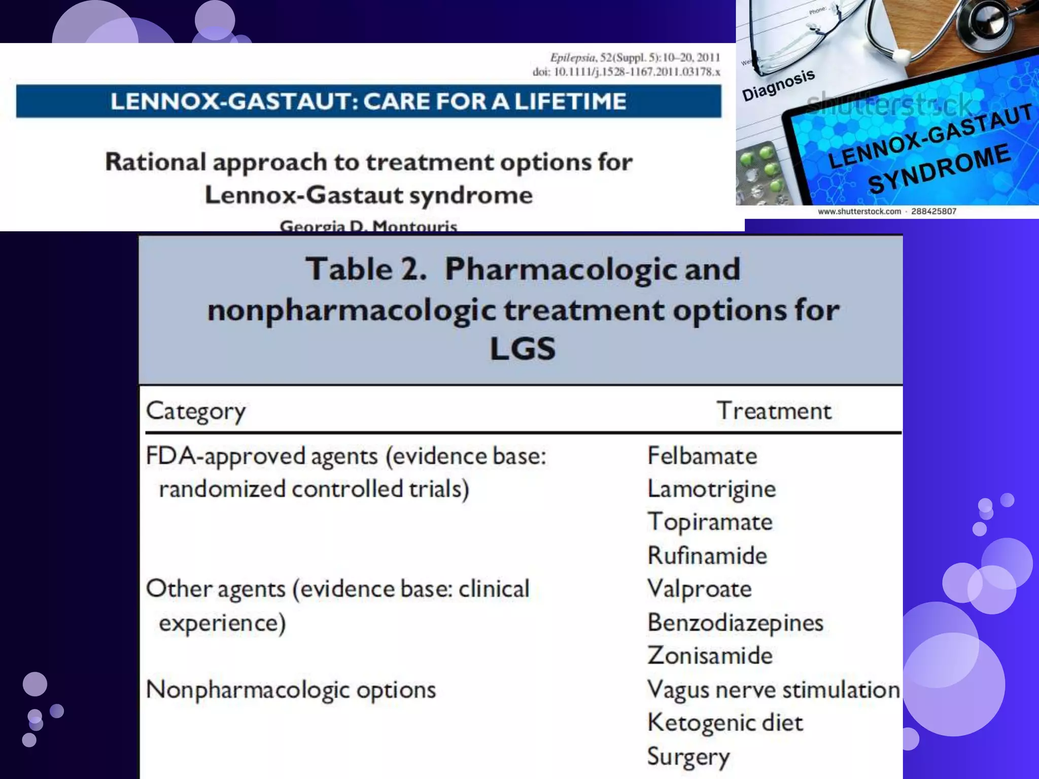 Refractory pediatric epilepsy ,Management | PPTX