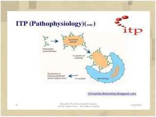 Refrat Idiopathic Purpura Trombocytopenic | PPTX