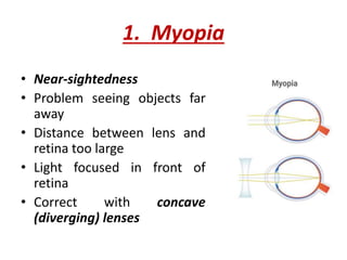 REFRECTIVE ERRORS.pptx refraction errors | PPT