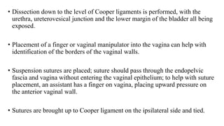 refreshed laparoscopic burch colposuspension.pptx