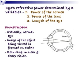 refractive surgeries | PPT