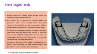 Space Regainers in Pediatric Dentistry.. | PPTX