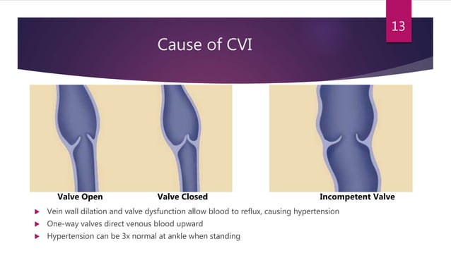 Epidermal Growth Factor use in Venous Leg Ulcers, Pressure Ulcers ...