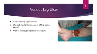 Epidermal Growth Factor use in Venous Leg Ulcers, Pressure Ulcers ...