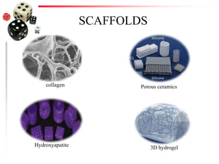 Regenerative endodontics & Revascularization | PPTX