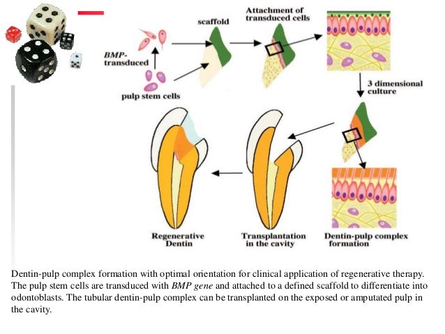 Regenerative endodontics & Revascularization