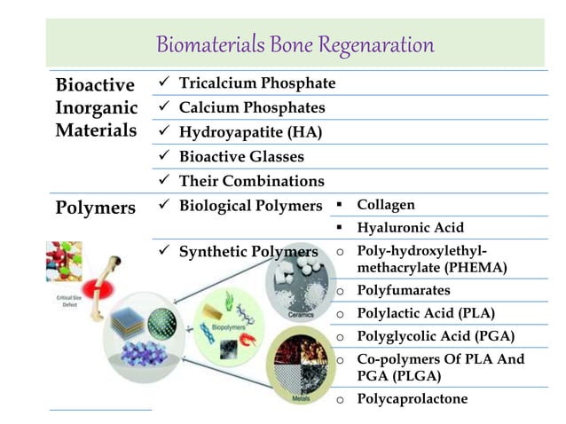 Biomaterials in Bone Regeneration | PPTX