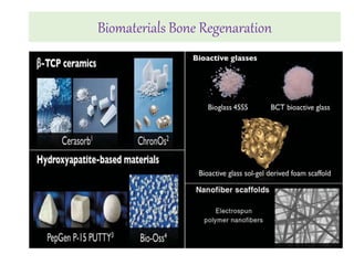 Biomaterials in Bone Regeneration | PPTX