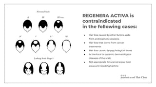 Regenera activa vs Hair transplant | Dr Tyng Tan Aesthetics and Hair ...