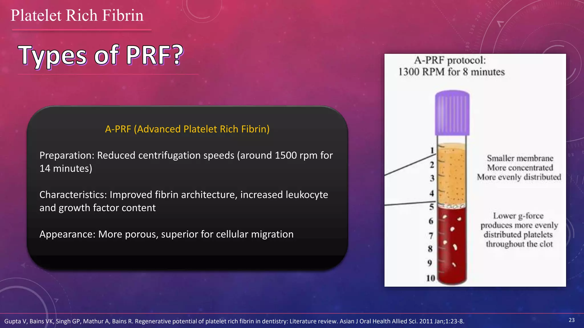Regenerative Endodontics | PPTX