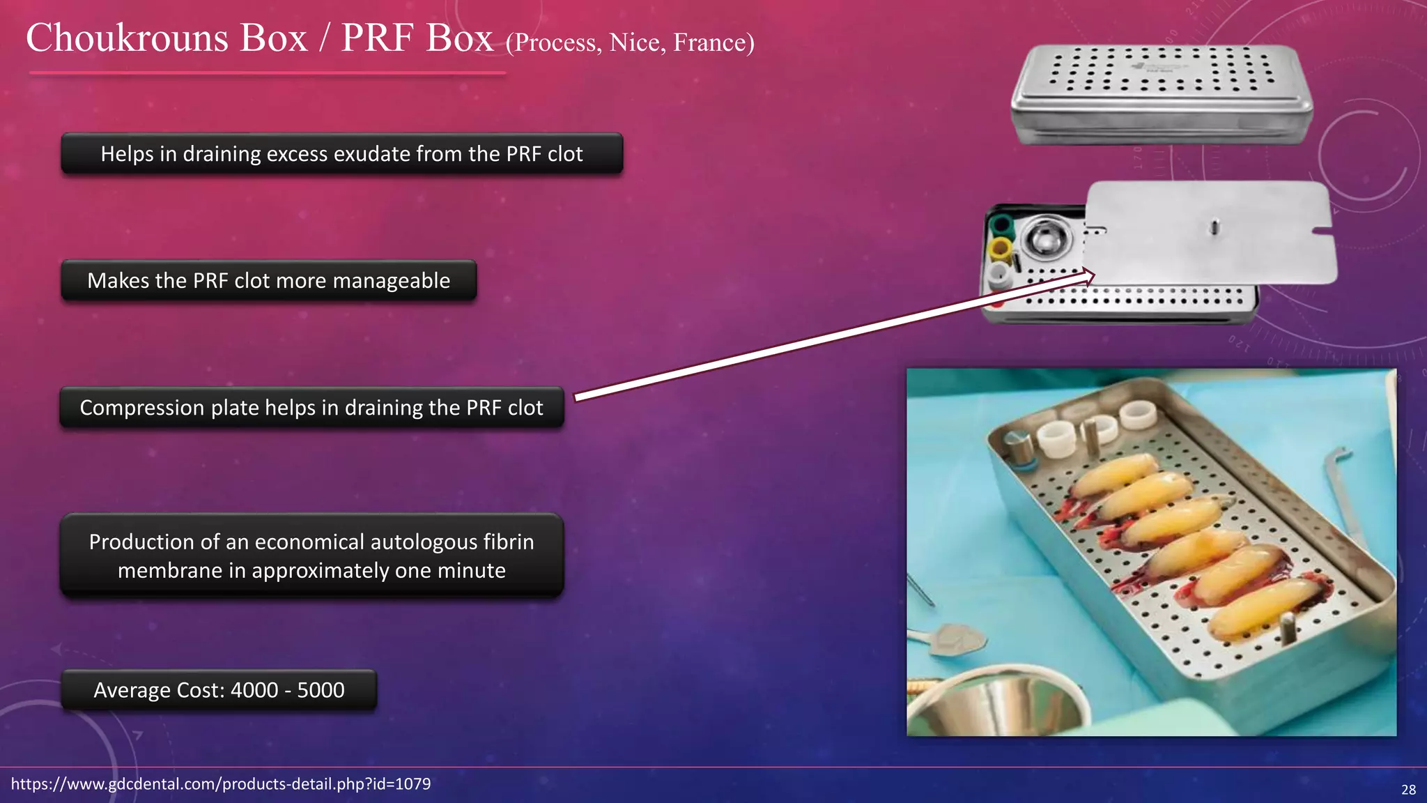 Regenerative Endodontics | PPTX