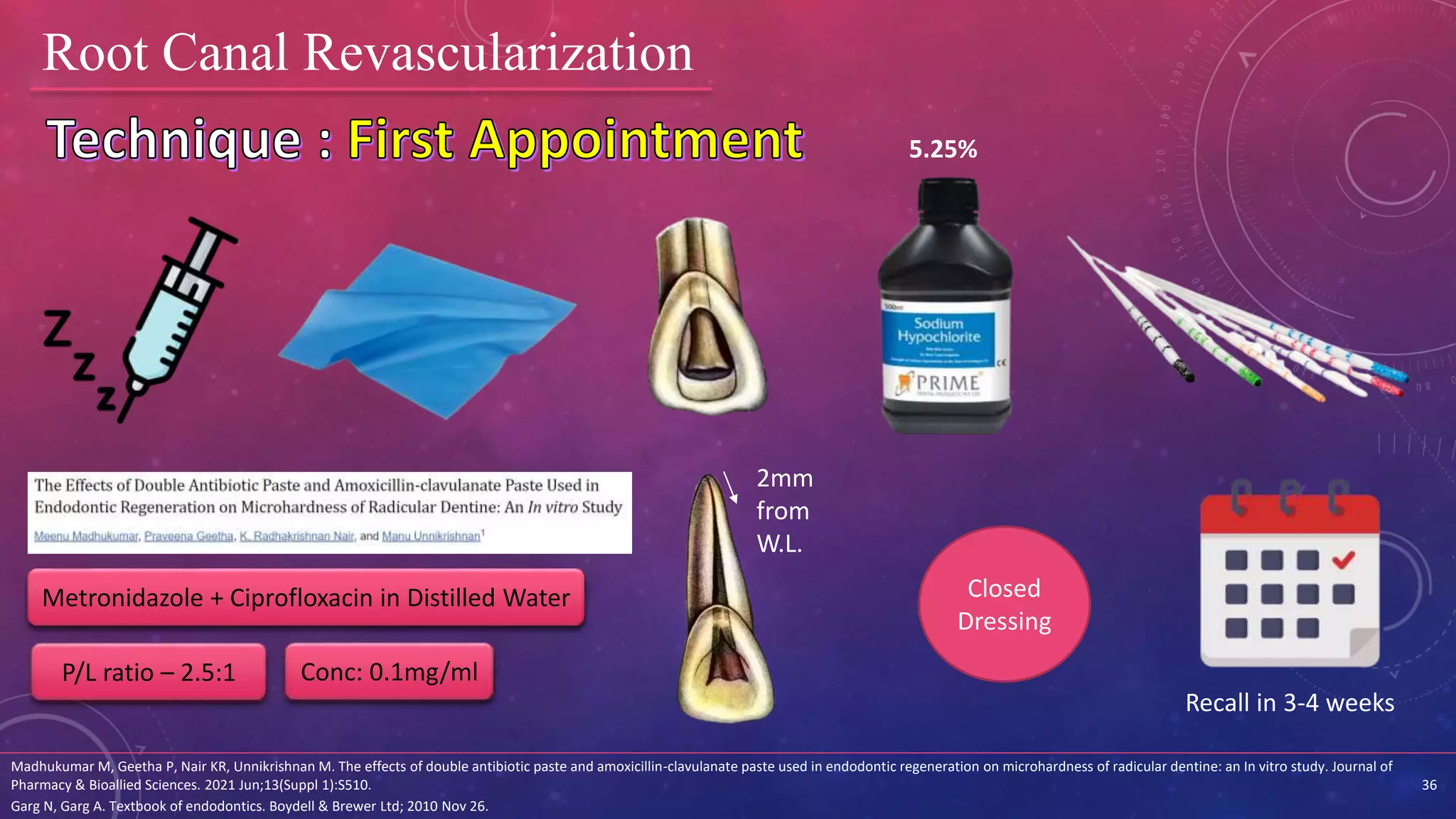 Regenerative Endodontics | PPTX