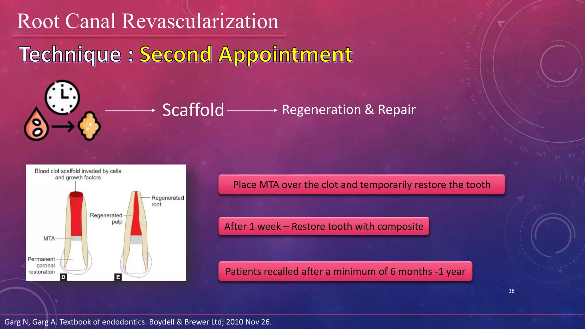 Regenerative Endodontics | PPTX