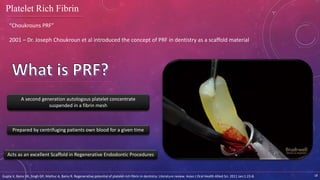 Regenerative Endodontics | PPTX