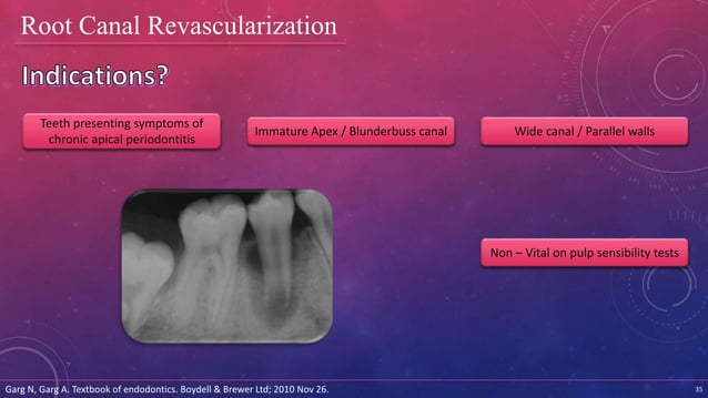 Regenerative Endodontics | PPTX | Dental Health | Diseases and Conditions