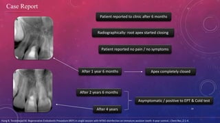 Regenerative Endodontics | PPTX
