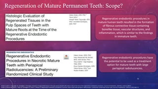 Regenerative Endodontics | PPTX