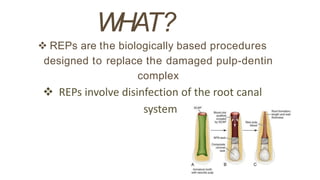 REGENERATIVE ENDODONTICS- oral endodontics | PPTX