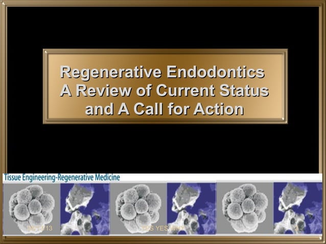 Regenerative Endodontics | PPT | Dental Health | Diseases and Conditions