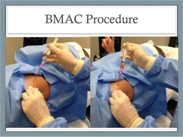 Regenerative Medicine