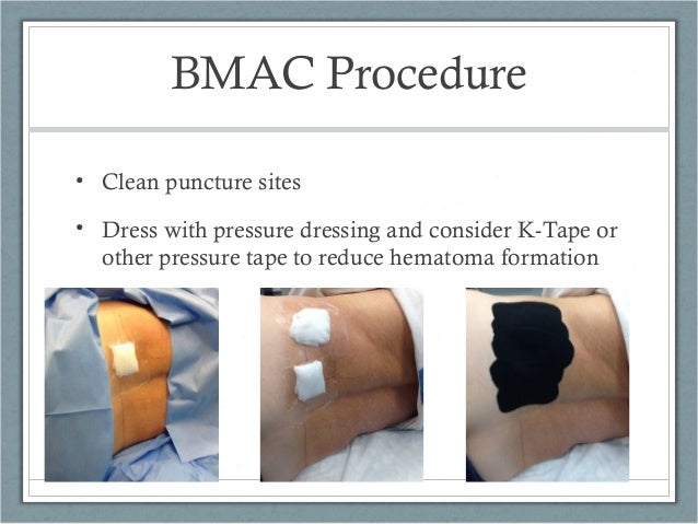 Regenerative Medicine