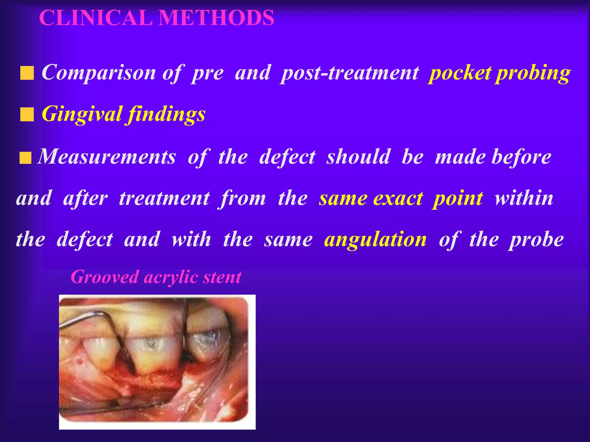 REGENERATIVE OSSEOUS SURGERY.ppt