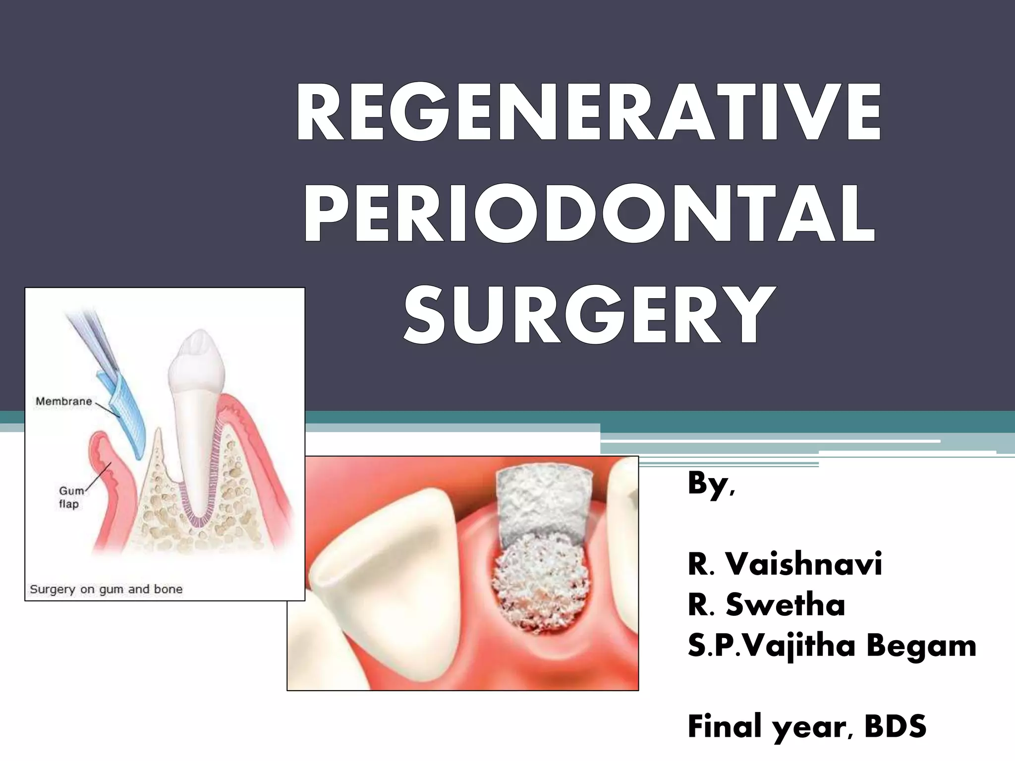 Regenerative periodontal surgery | PPTX