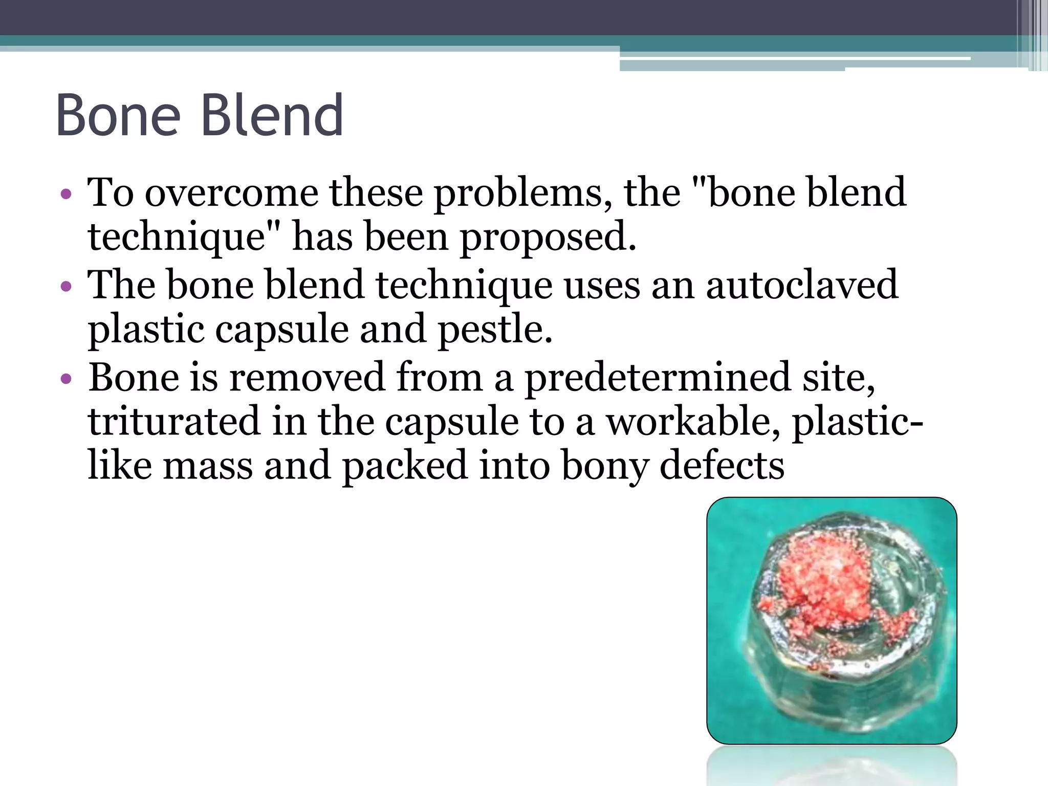 Regenerative periodontal surgery | PPTX