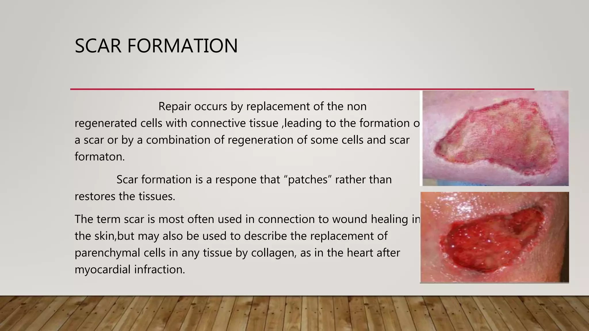 regenration and scar formation.pptx