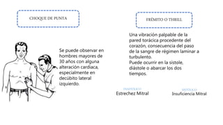 Región Precordial | PPTX