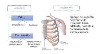 Región Precordial | PPTX