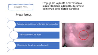 Región Precordial | PPTX