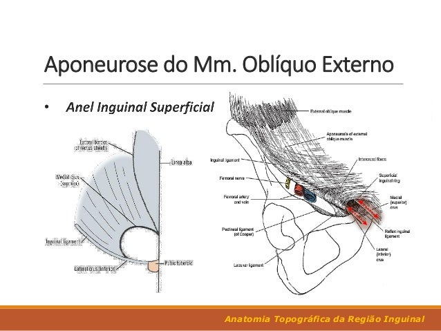Anatomia Topográfica da Região Inguinal
