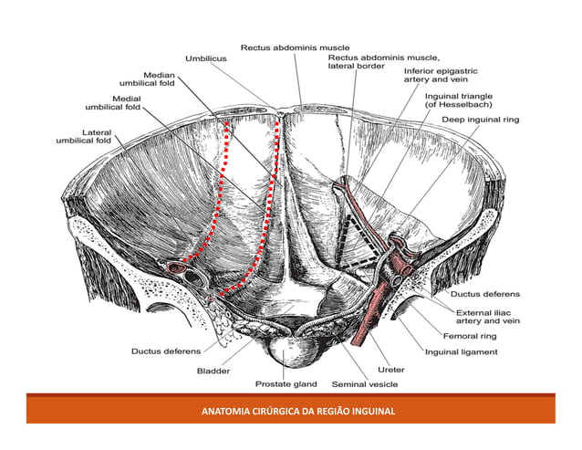 Anatomia Cirúrgica da Região Inguinal | PDF
