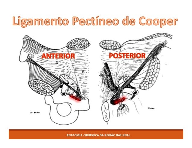 Anatomia Cirúrgica da Região Inguinal