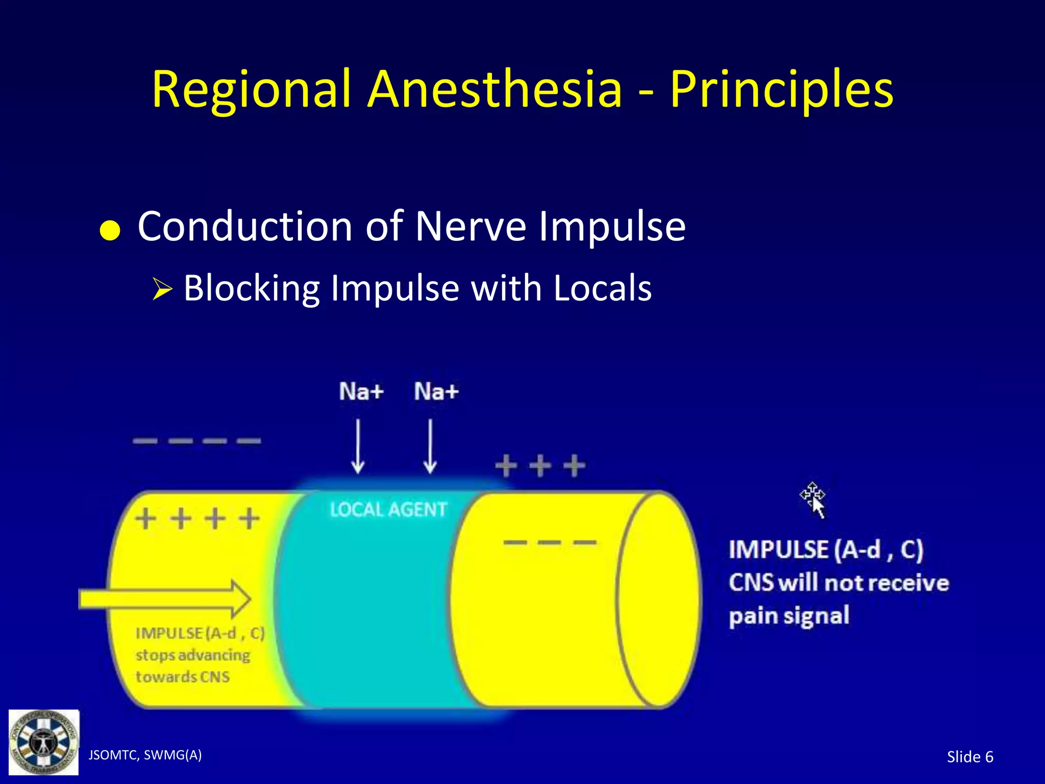 regional-anesthesia-priciples.ppt