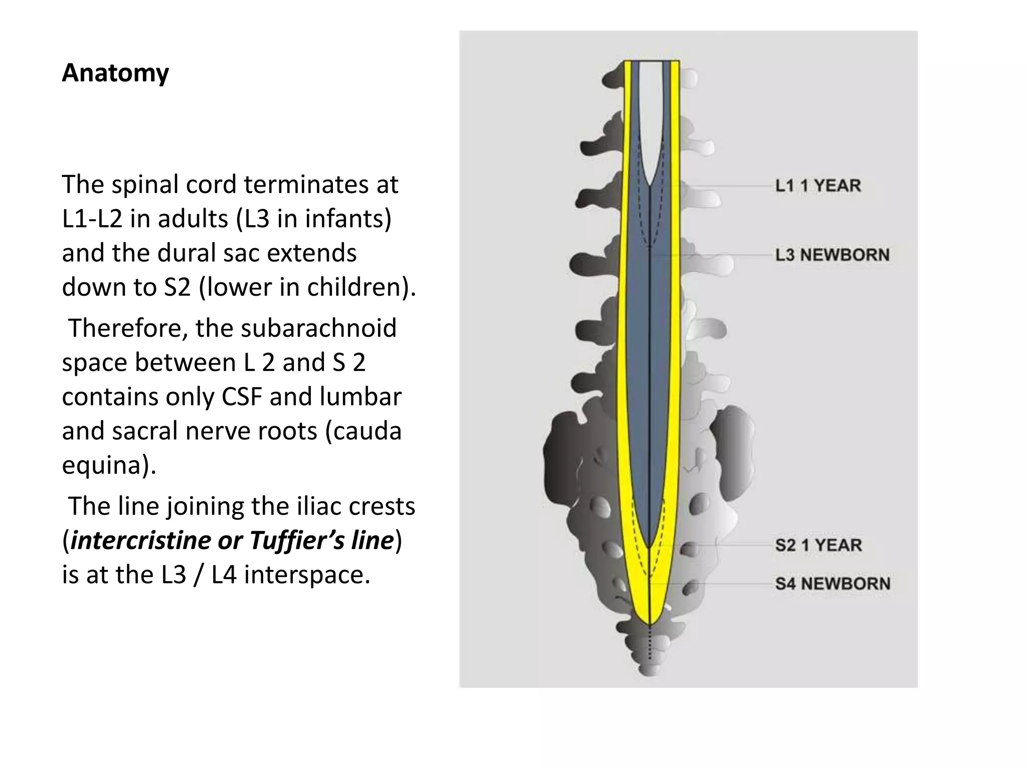 Regional anaesthesia in Pediatrics | PPTX