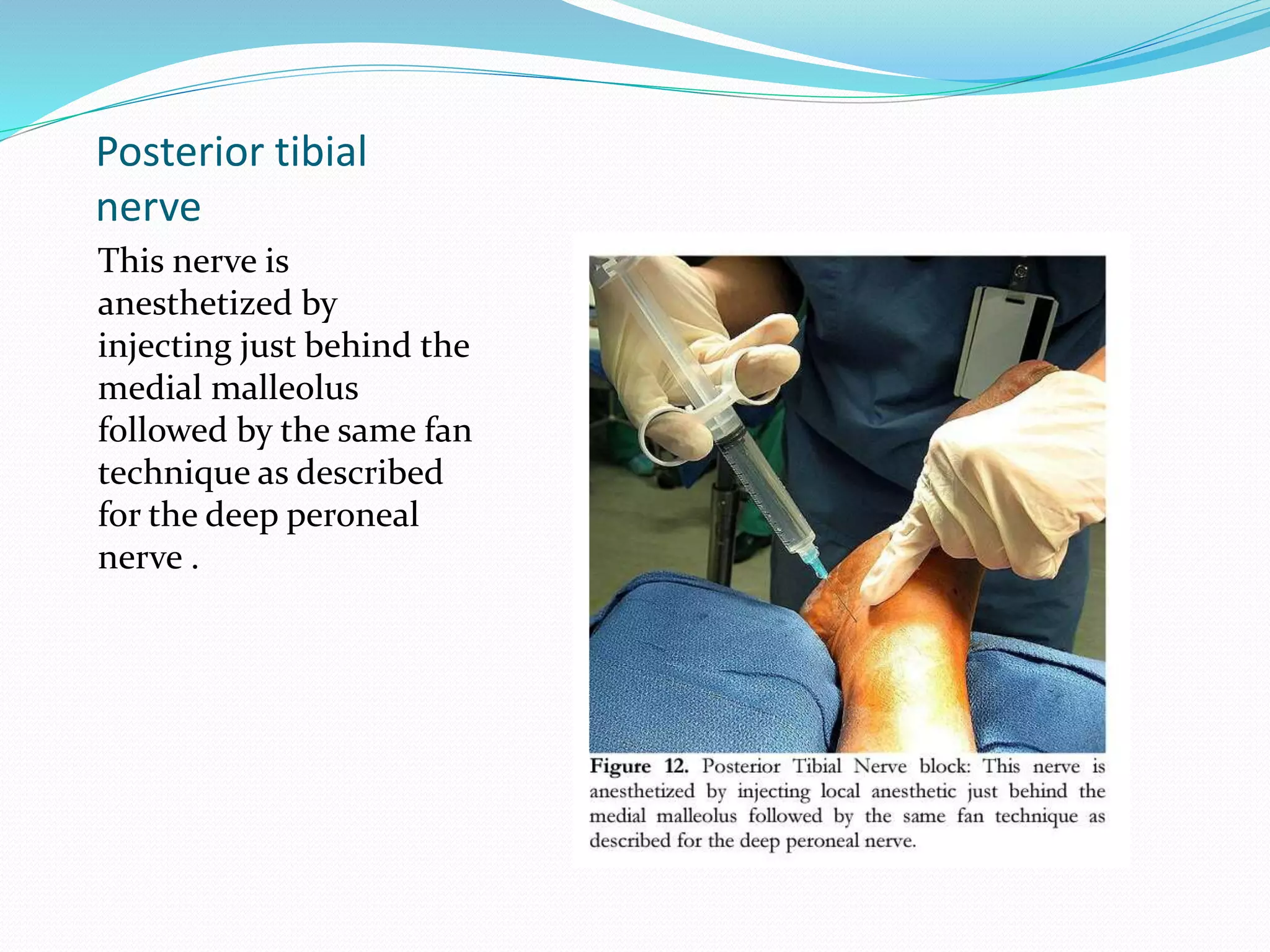 Regional anaesthesia lower limb blocks | PPTX